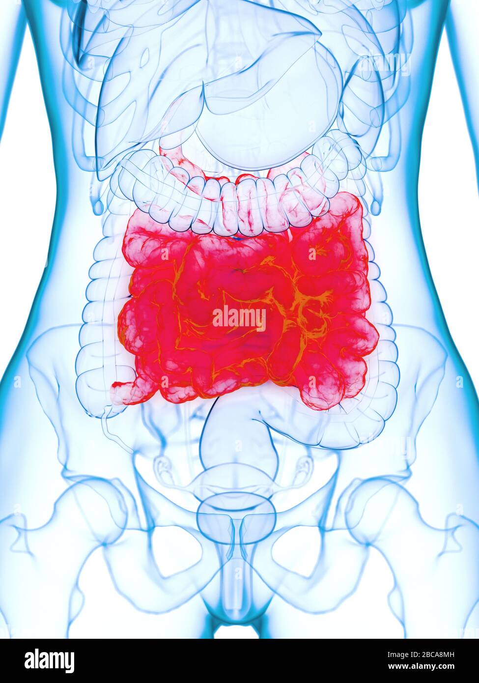 Diseased small intestine, illustration Stock Photo - Alamy