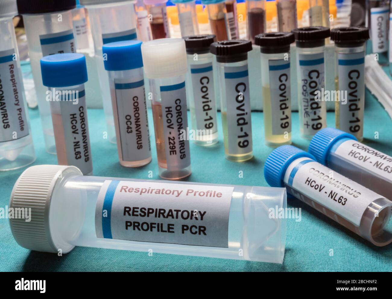 Vials containing samples from patients infected with covid19 ...