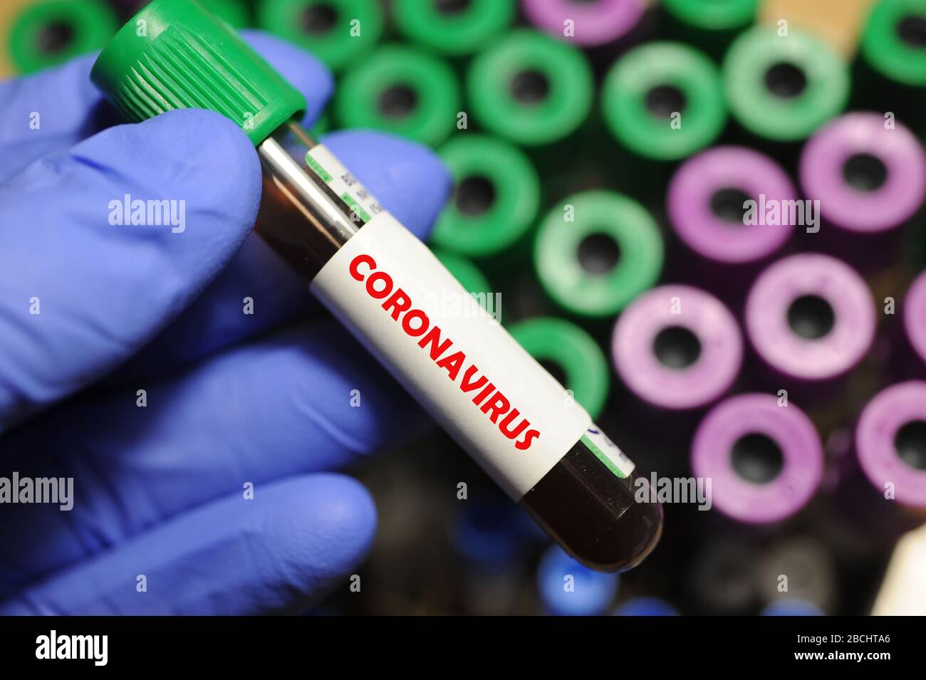 Test tube with blood for testing. Testing blood Stock Photo - Alamy