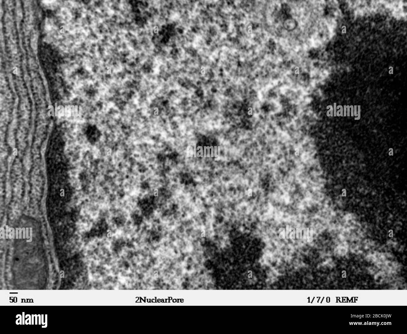 Transmission electron microscope image Black and White Stock Photos ...