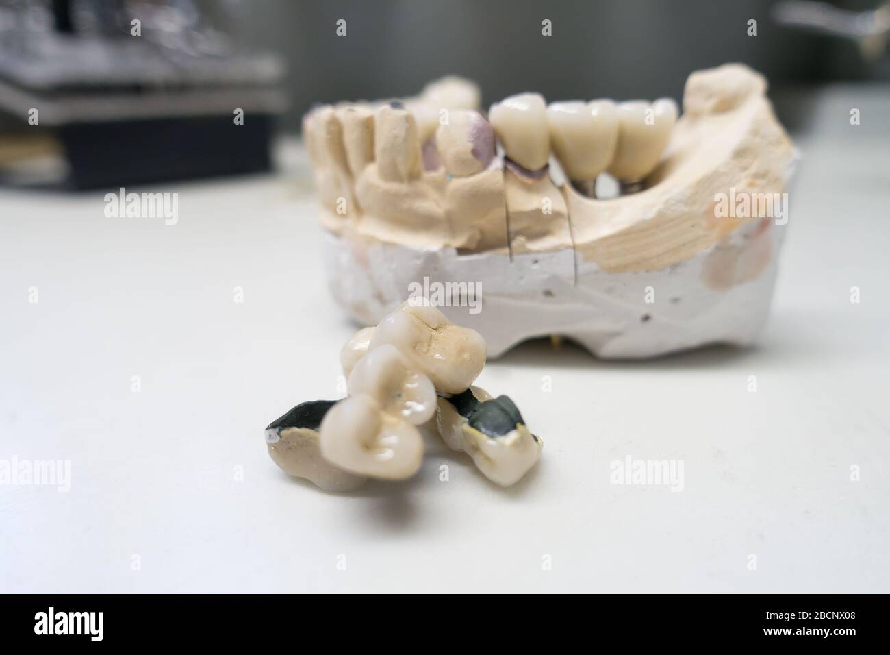 Dental impression human teeth hi-res stock photography and images - Alamy