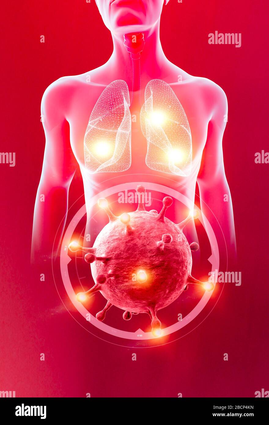 Organ infection hi-res stock photography and images - Alamy