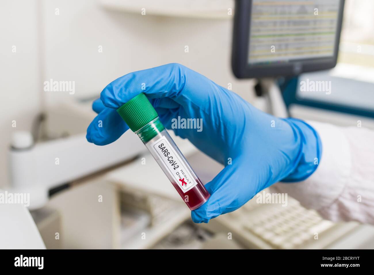 Blood analyzer hi-res stock photography and images - Alamy