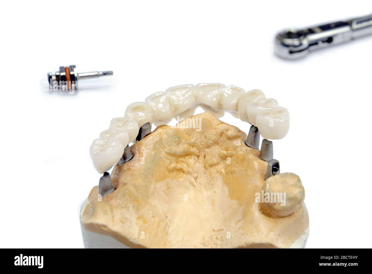 the process of manufacturing ceramic teeth on implants. dental implants ...