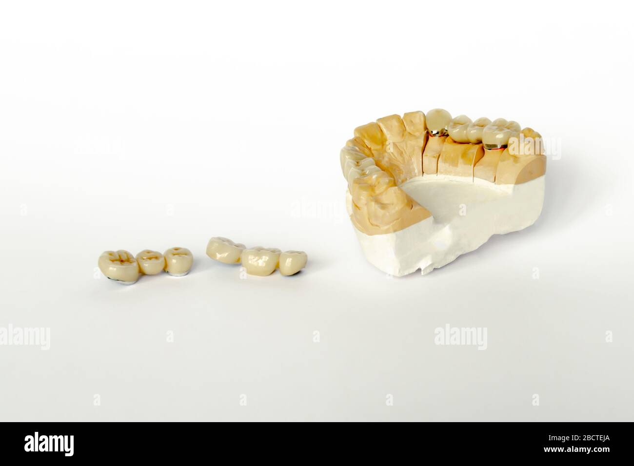prosthetics for missing teeth. false teeth. ceramic-metal dental ...