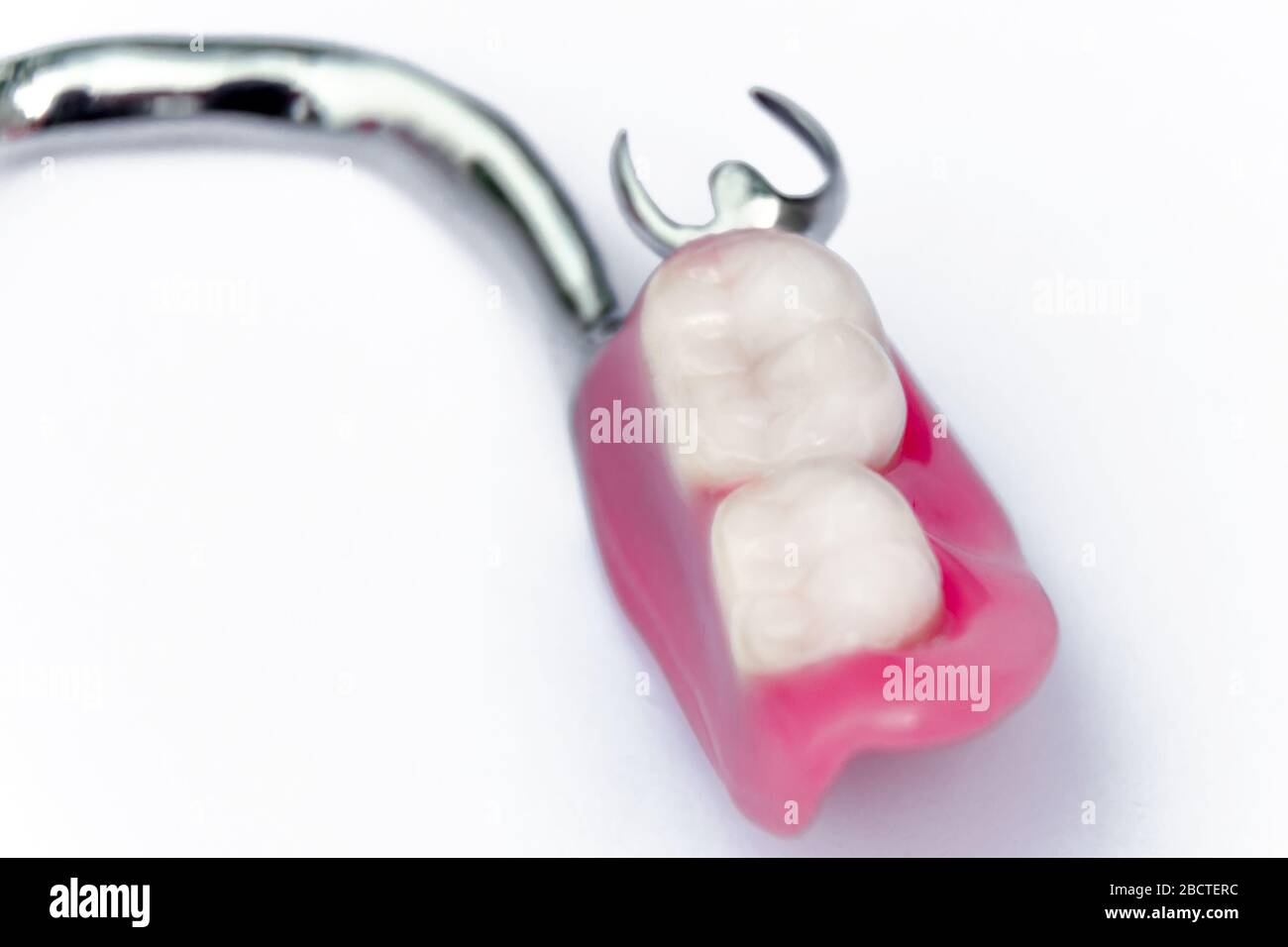 concept of orthopedic dentistry. dental prosthetics. removable lower ...