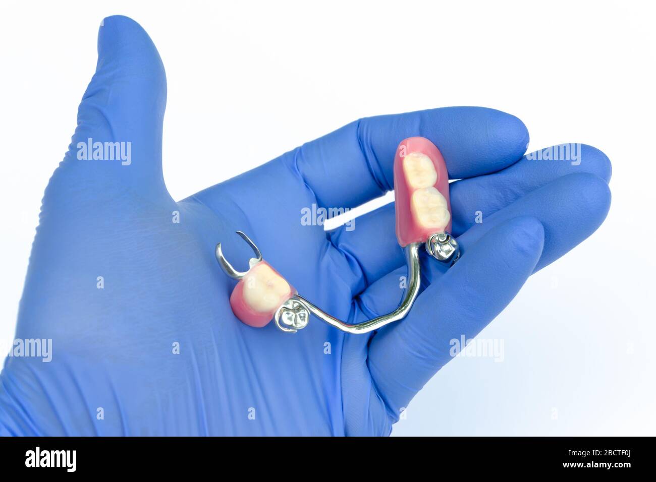 orthopedic dentistry. removable prosthetics. prosthetics with clasp ...