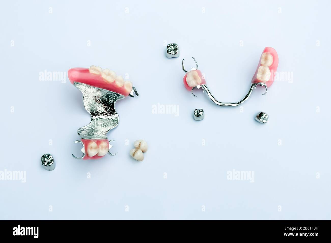 a set of removable clasp prostheses with ceramic-metal crowns on the ...
