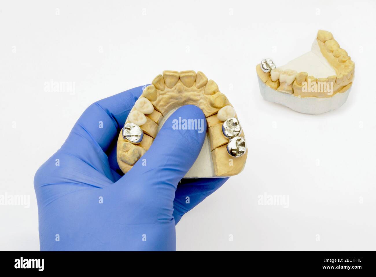 Porcelain false teeth hi-res stock photography and images - Alamy