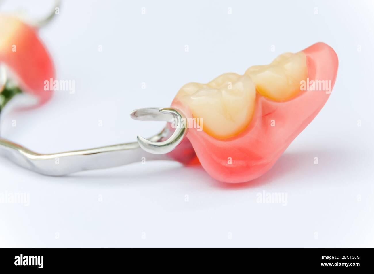 clasp prosthesis on the lower jaw isolated Stock Photo - Alamy
