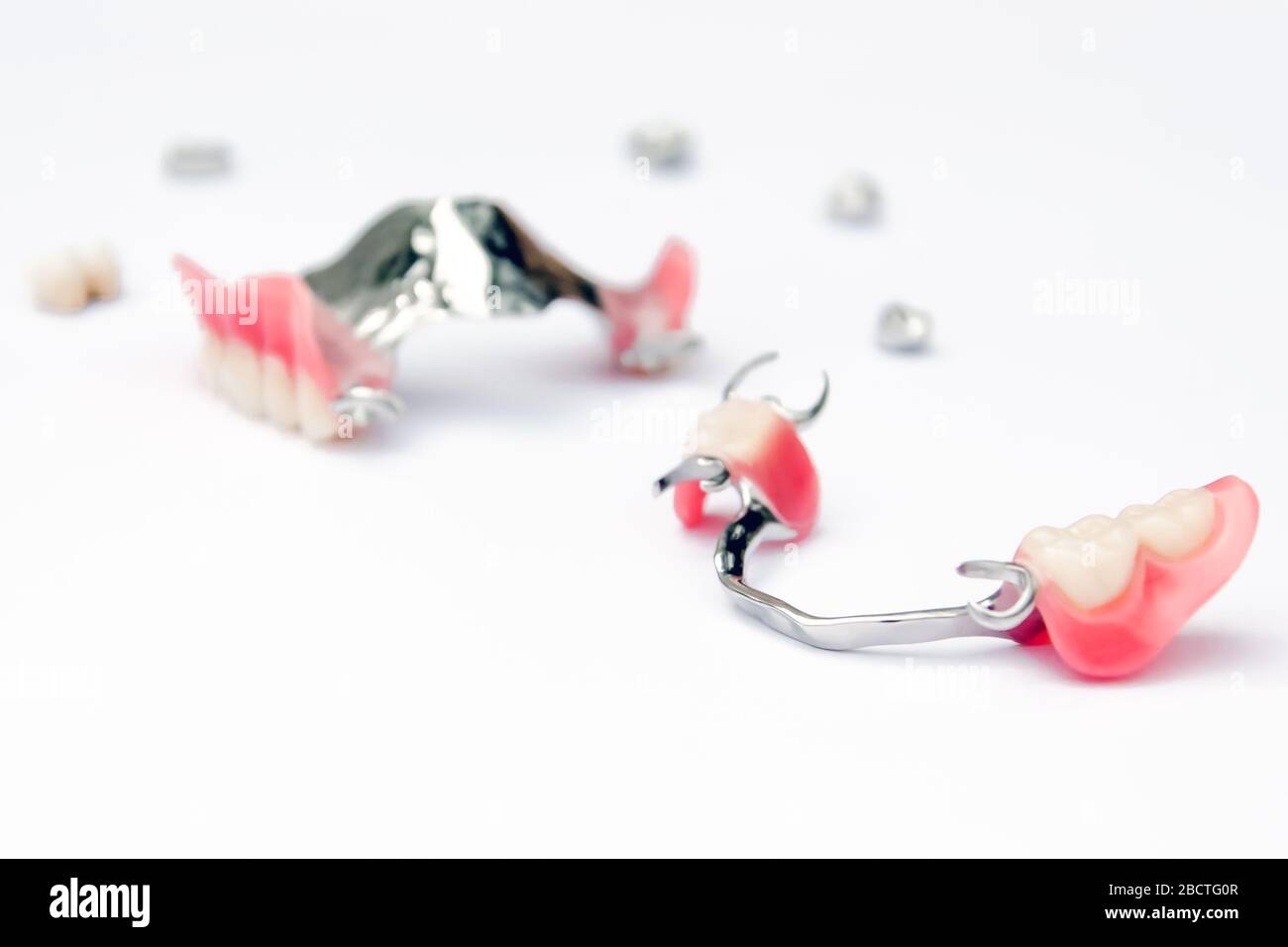 a set of removable clasp prostheses with supporting metal-ceramic and ...
