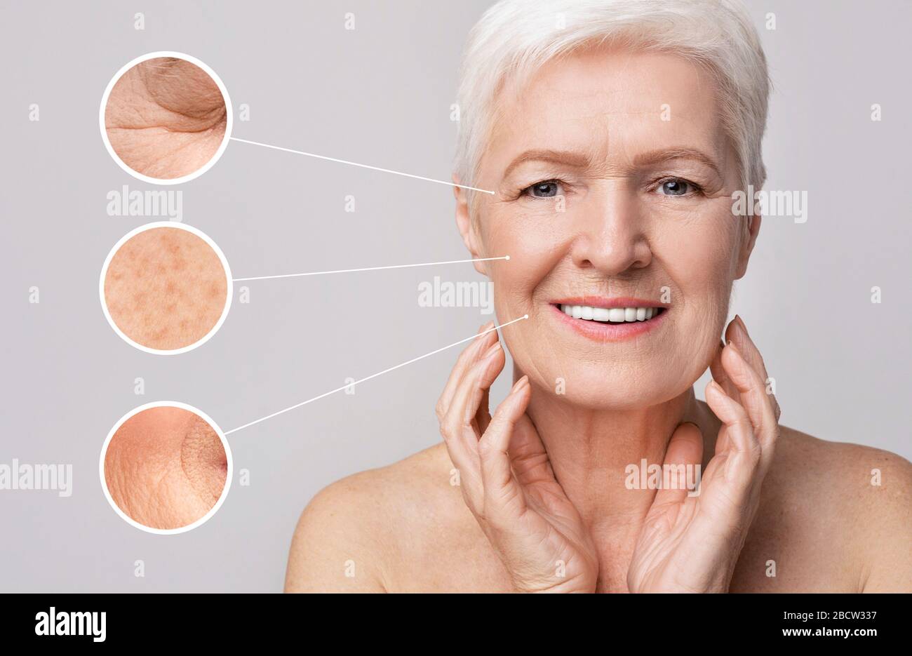 Beautiful senior woman portrait with zoomed zones with skin aging signs ...
