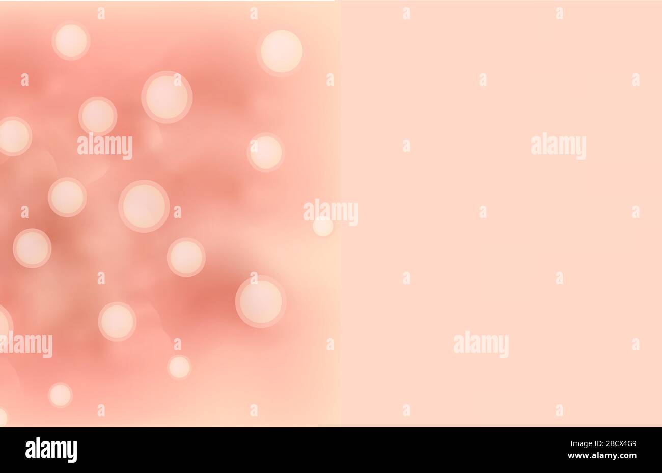 Texture, inflamed pimples and acne. Before After acne. Skin background ...