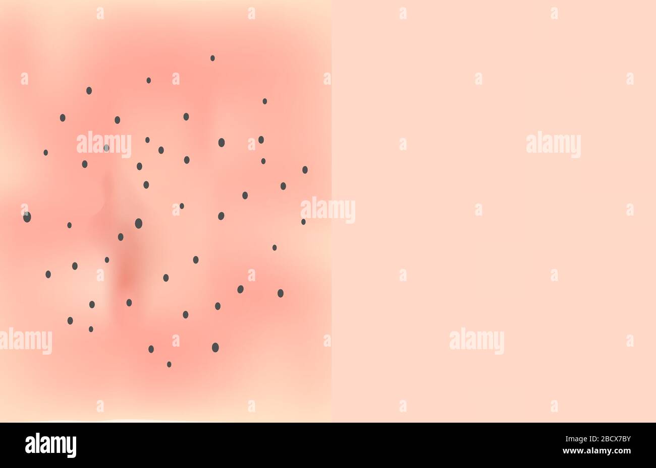 Skin texture with black dots of acne. Before After acne. Skin ...