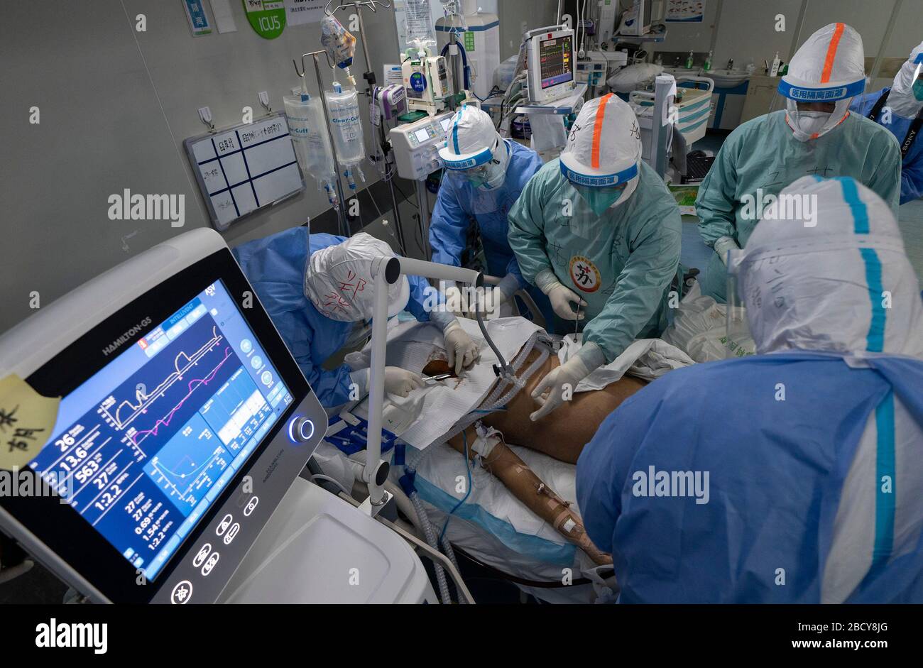 Ecmo machine hi-res stock photography and images - Alamy