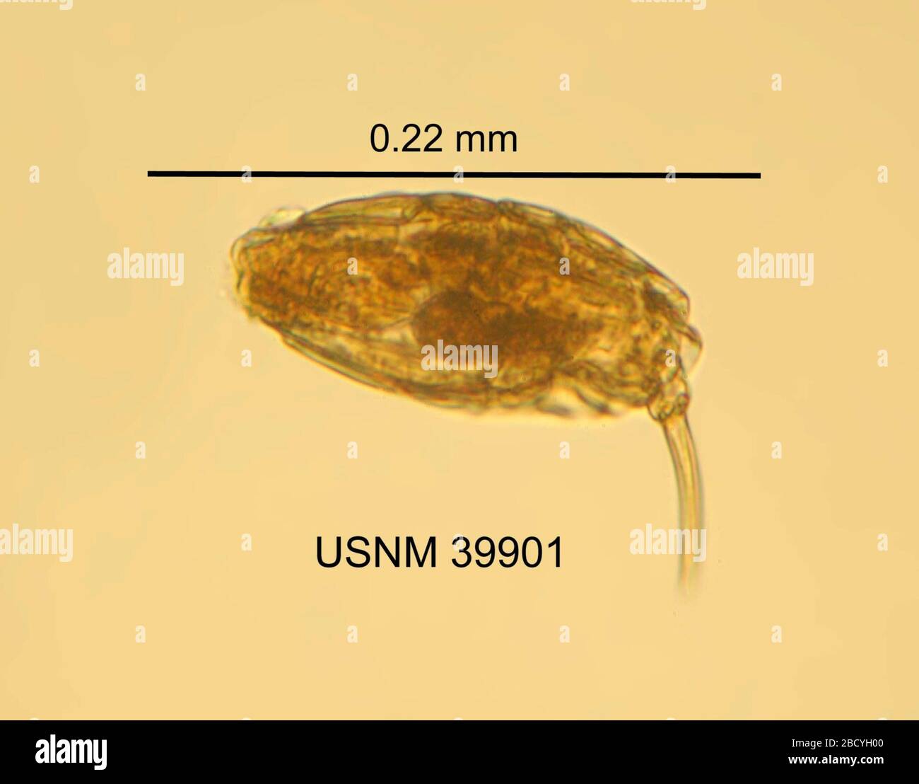 Lecane signifera ploenensis. 10 Jan 20131 Lecane signifera ploenensis ...