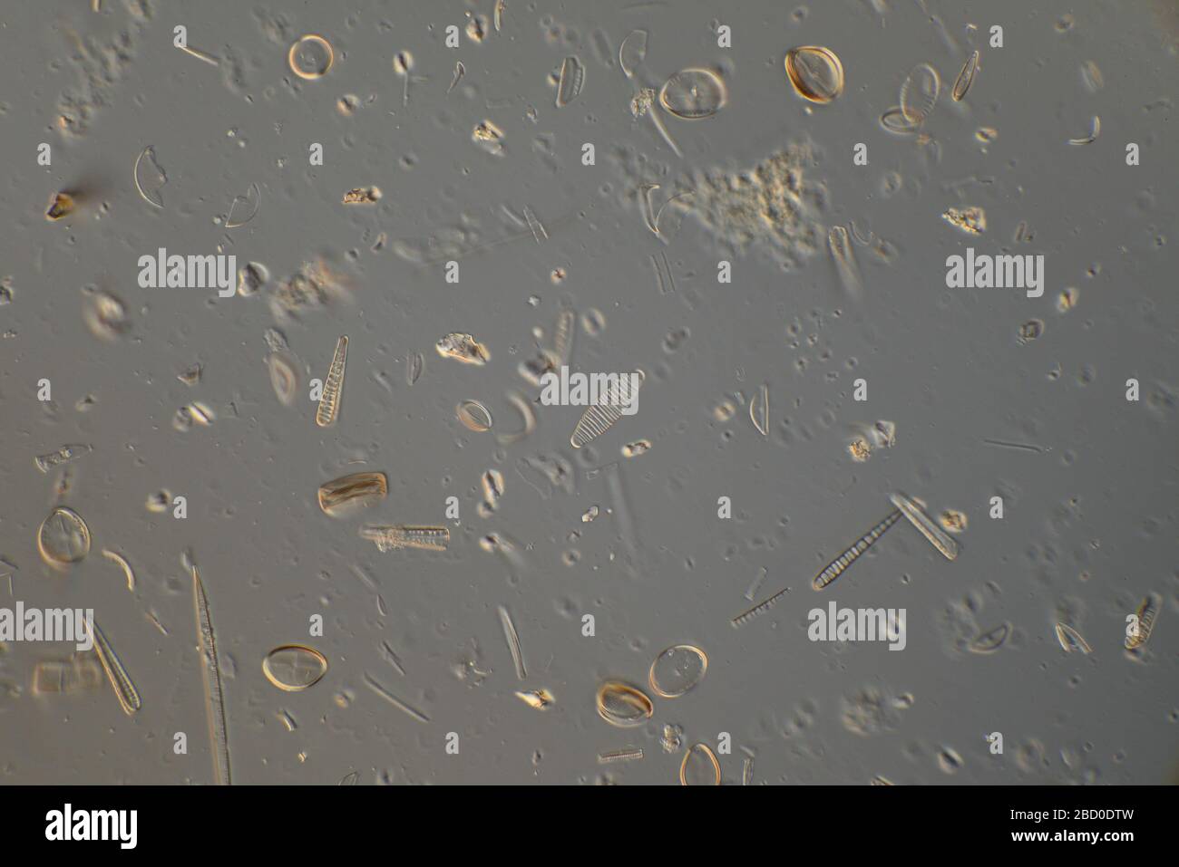 Diatom algae microscopy hi-res stock photography and images - Alamy