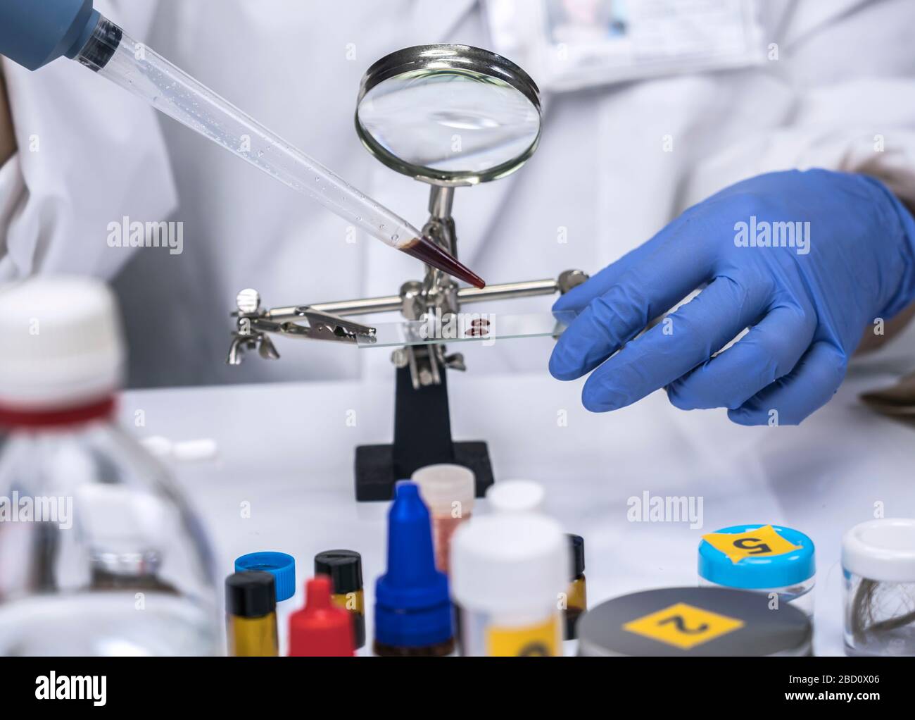 Specialized police taking shows blood in microscope holder to analyze ...