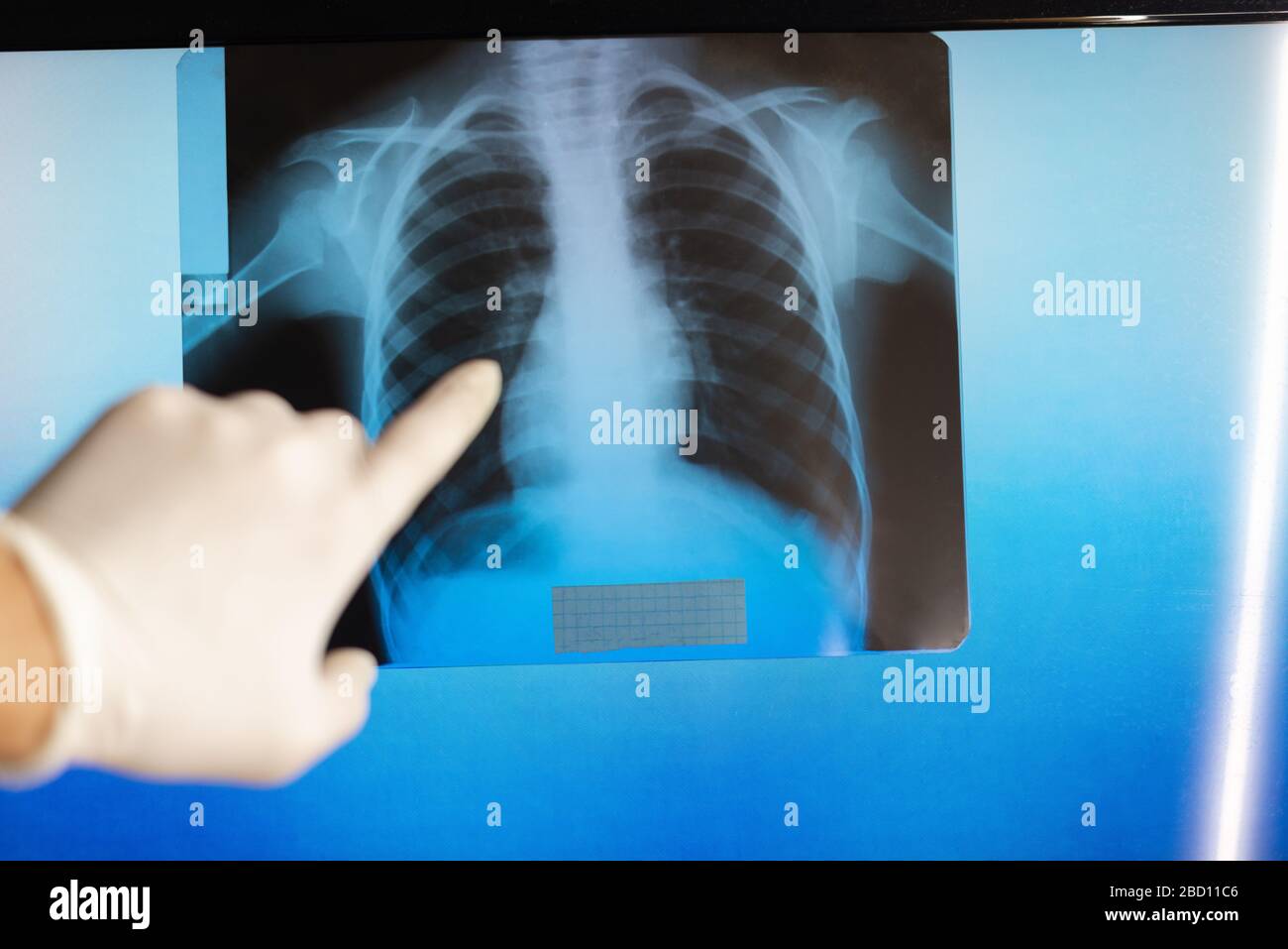 Hospital radiology radiography hi-res stock photography and images - Alamy