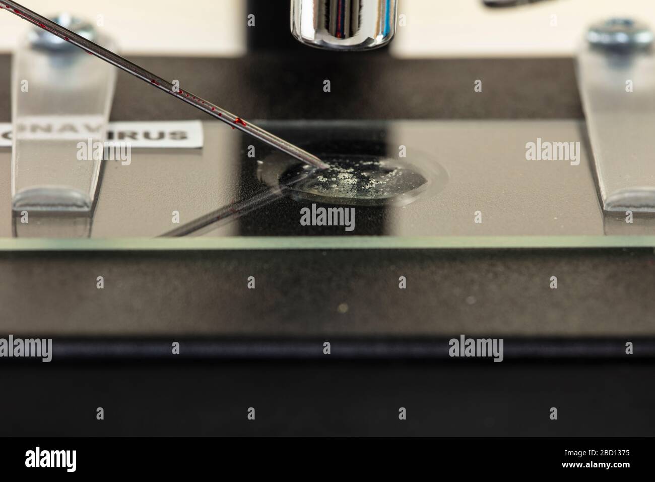 blood sample placed on a microscope slide Stock Photo - Alamy
