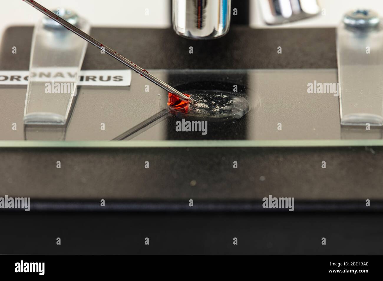 blood sample placed on a microscope slide Stock Photo - Alamy
