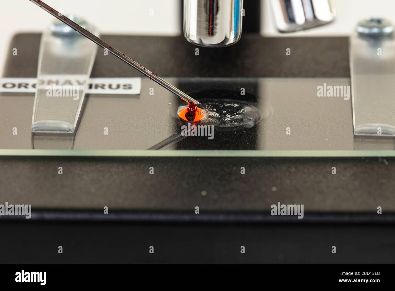 blood sample placed on a microscope slide Stock Photo - Alamy