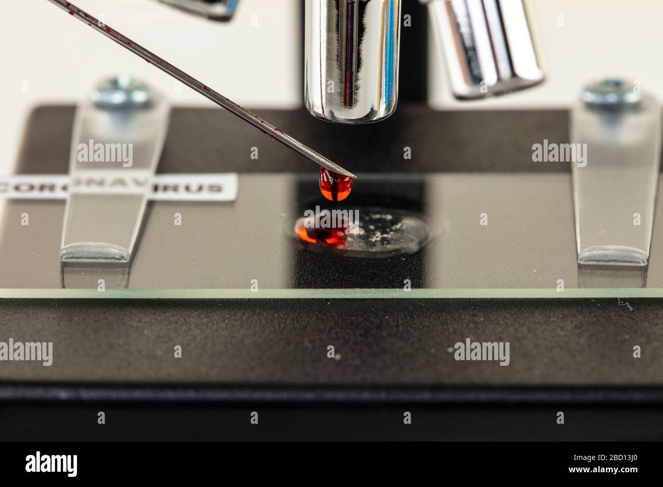 blood sample placed on a microscope slide Stock Photo - Alamy