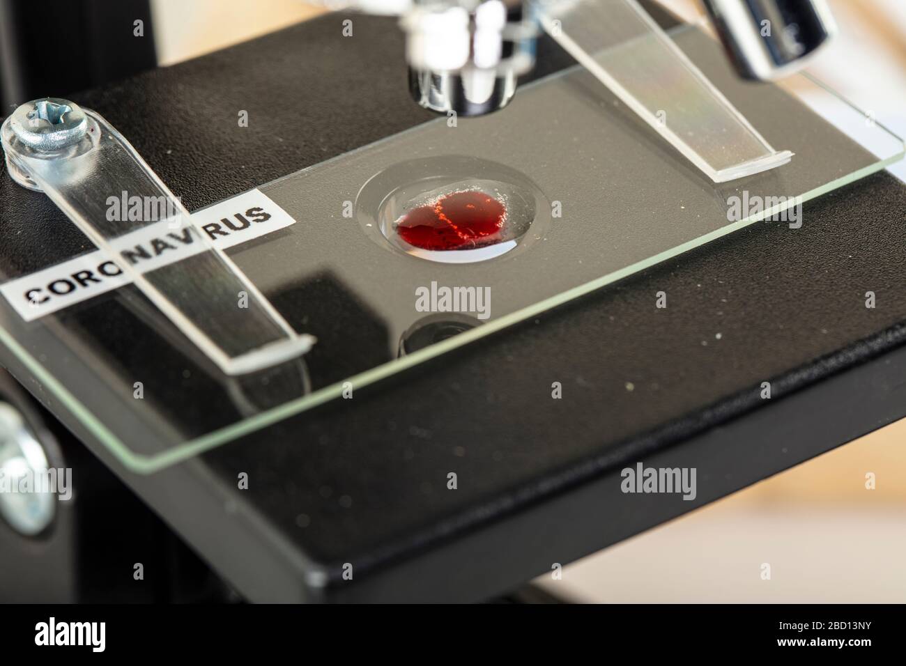 blood sample under a microscope in a laboratory, concept for testing ...