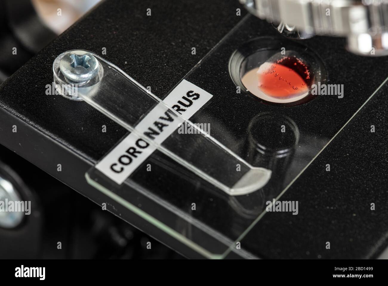 blood sample placed on a microscope slide Stock Photo - Alamy