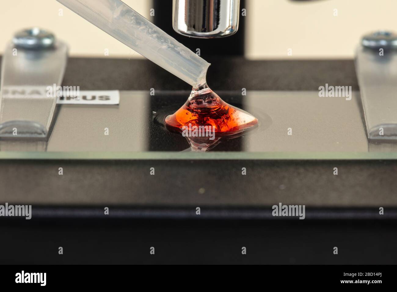 blood sample placed on a microscope slide Stock Photo - Alamy