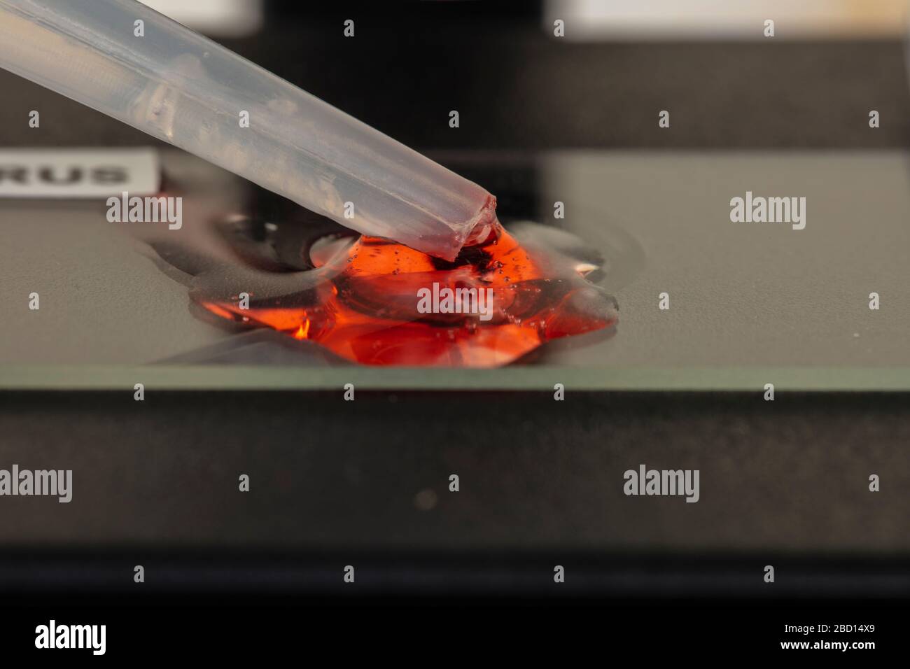 blood sample placed on a microscope slide Stock Photo - Alamy