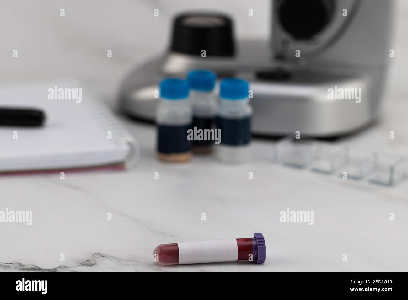 test tube with blood in laboratory close-up. Blood test concept Stock ...