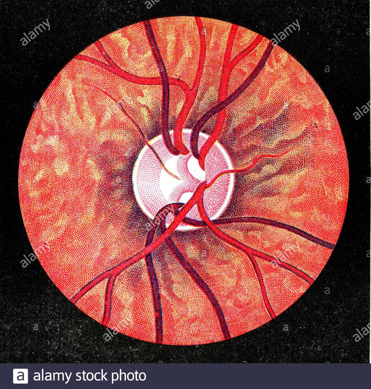 Fundus Eye Stock Photos & Fundus Eye Stock Images - Alamy