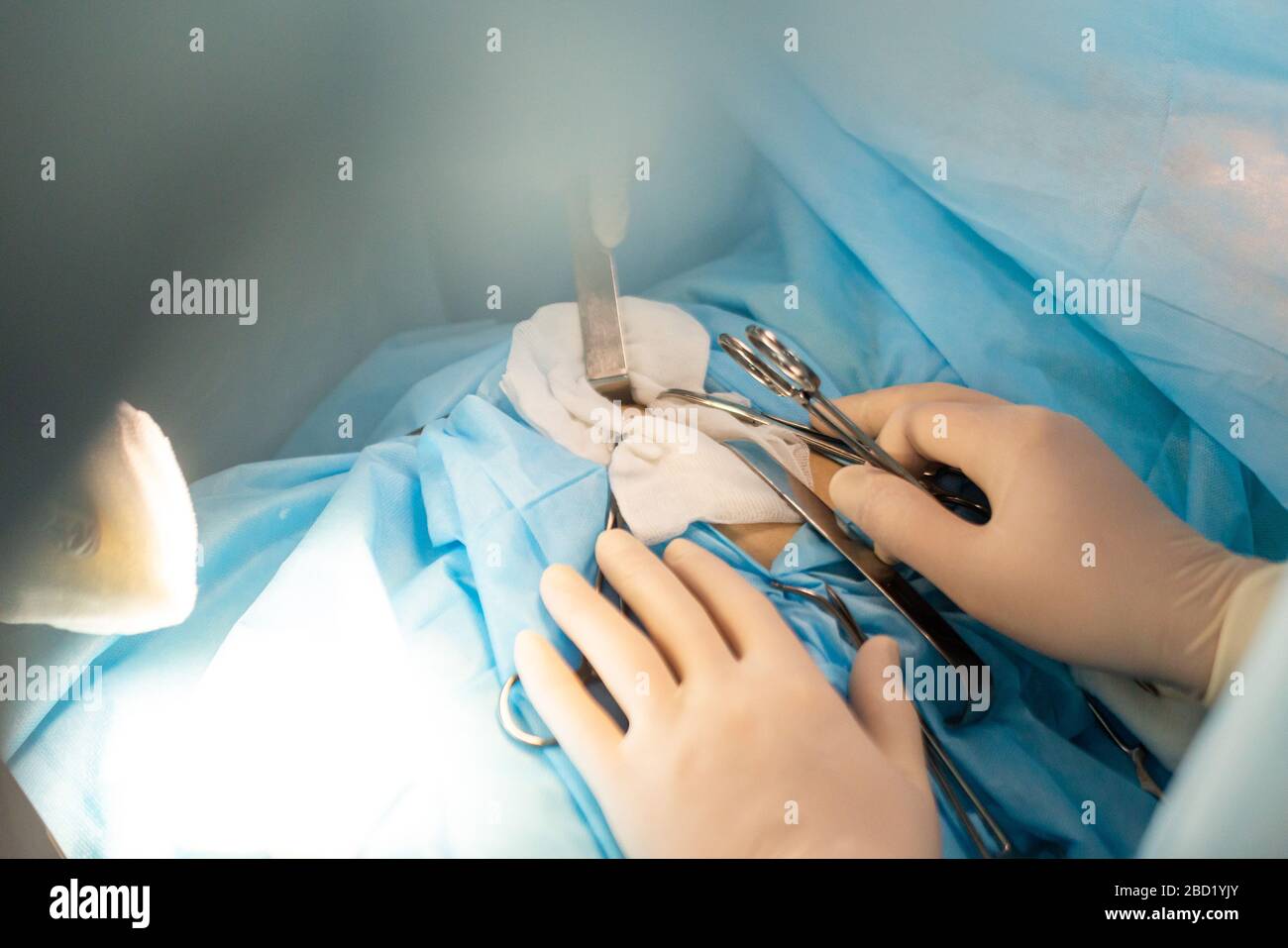 Close-ups of doctor's hands in medical gloves during surgery Stock ...