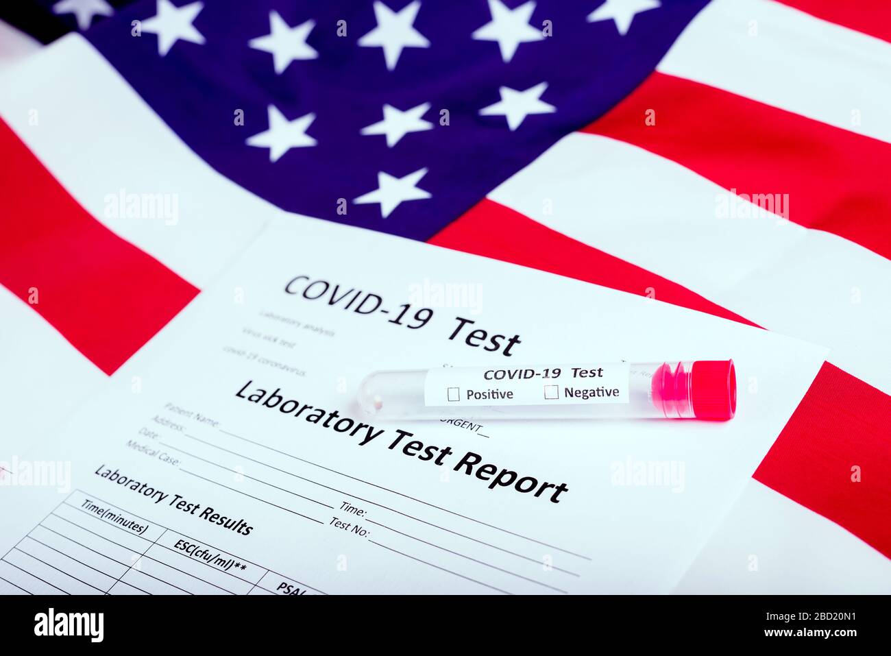 Laboratory test specialized in virus pandemics like covid-19 studies ...
