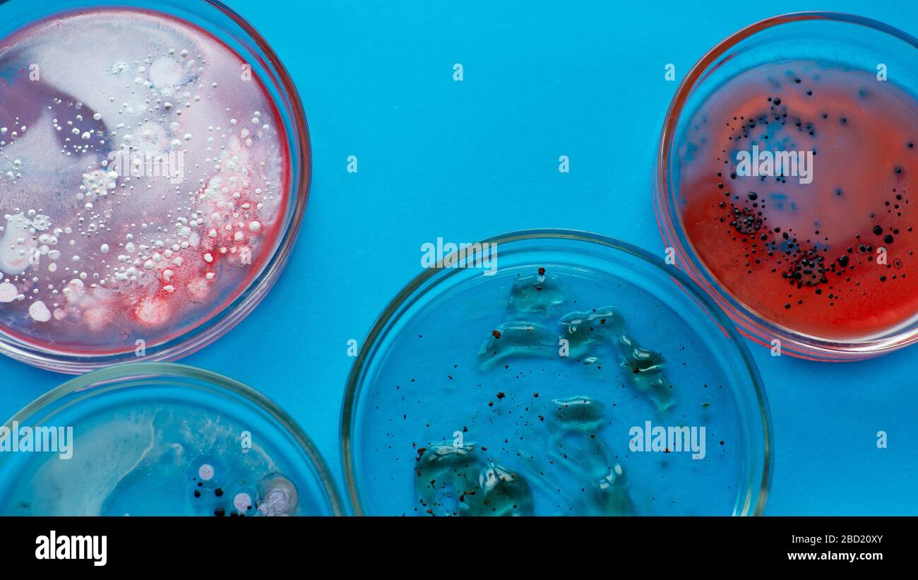 Epidemic and the global virus attack concept. Laboratory tests ...