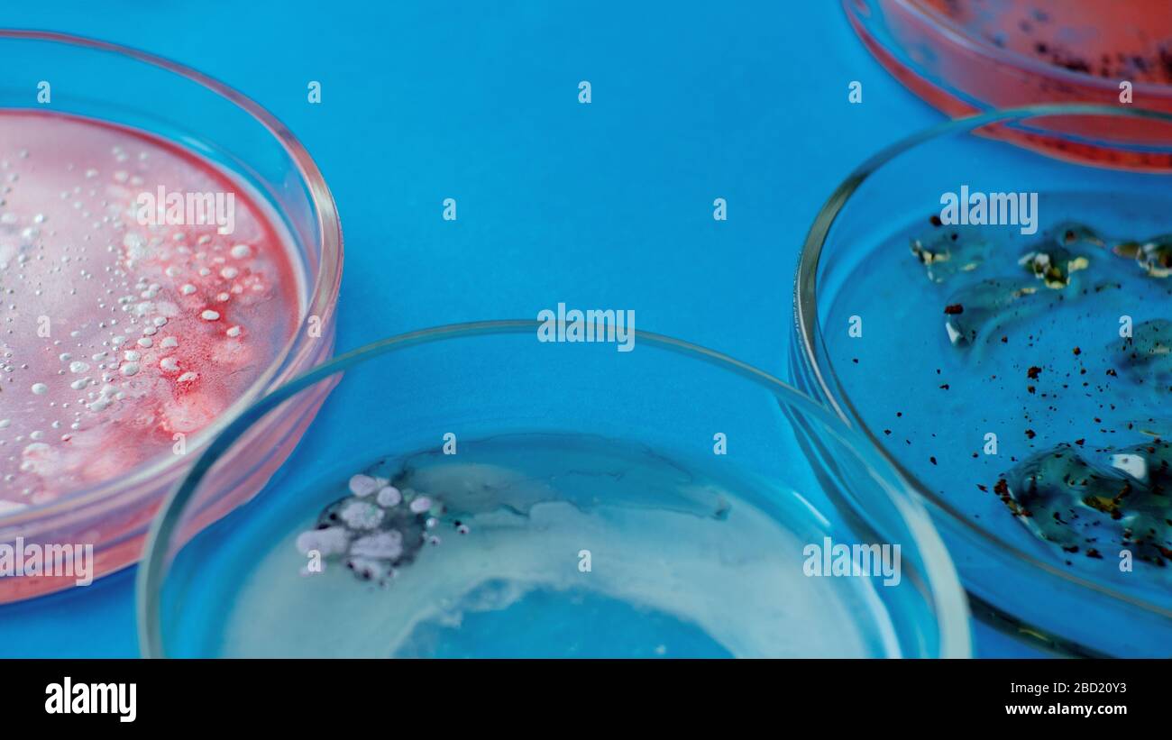 Epidemic and the global virus attack concept. Laboratory tests ...