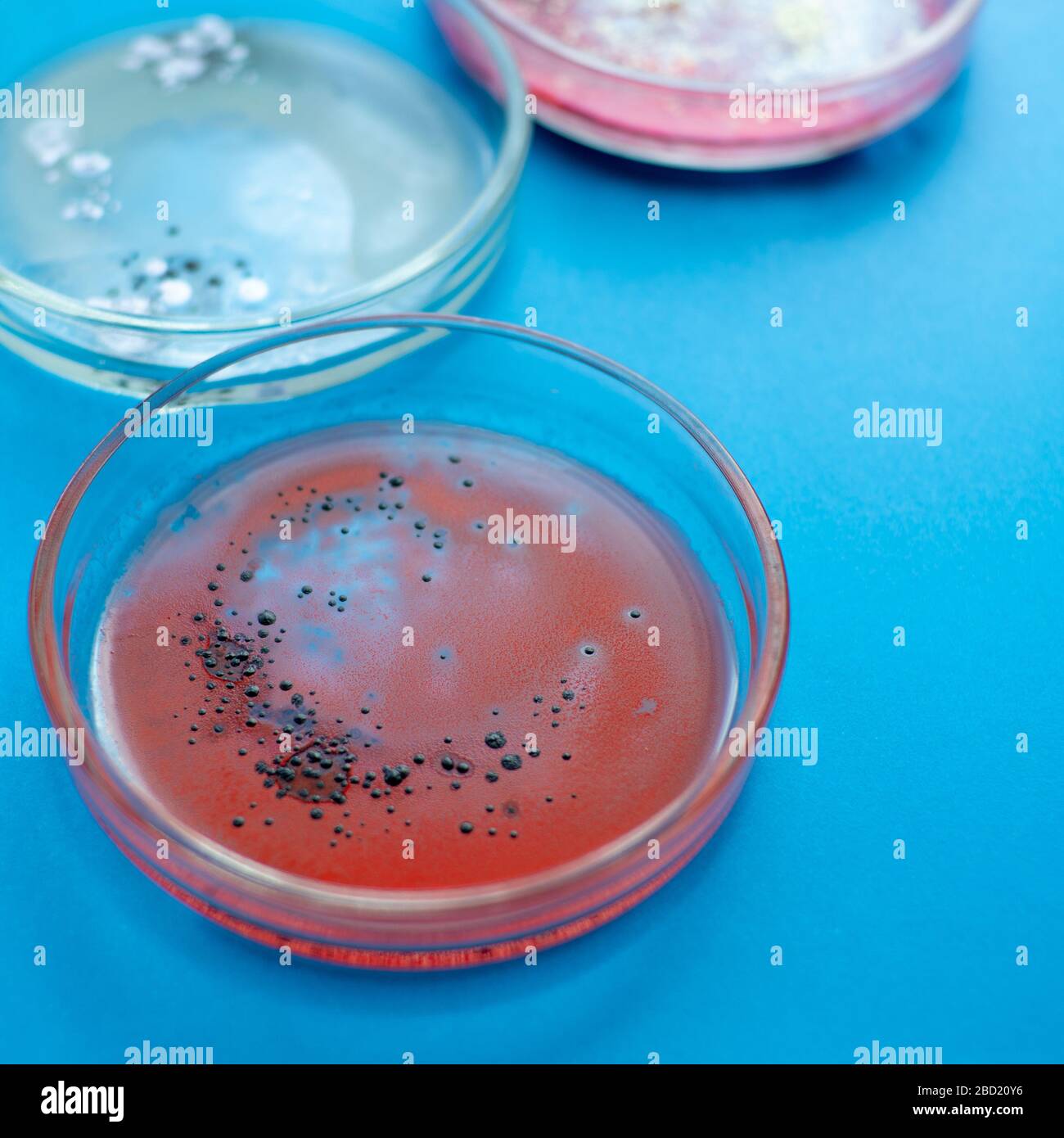 Epidemic and the global virus attack concept. Laboratory tests ...