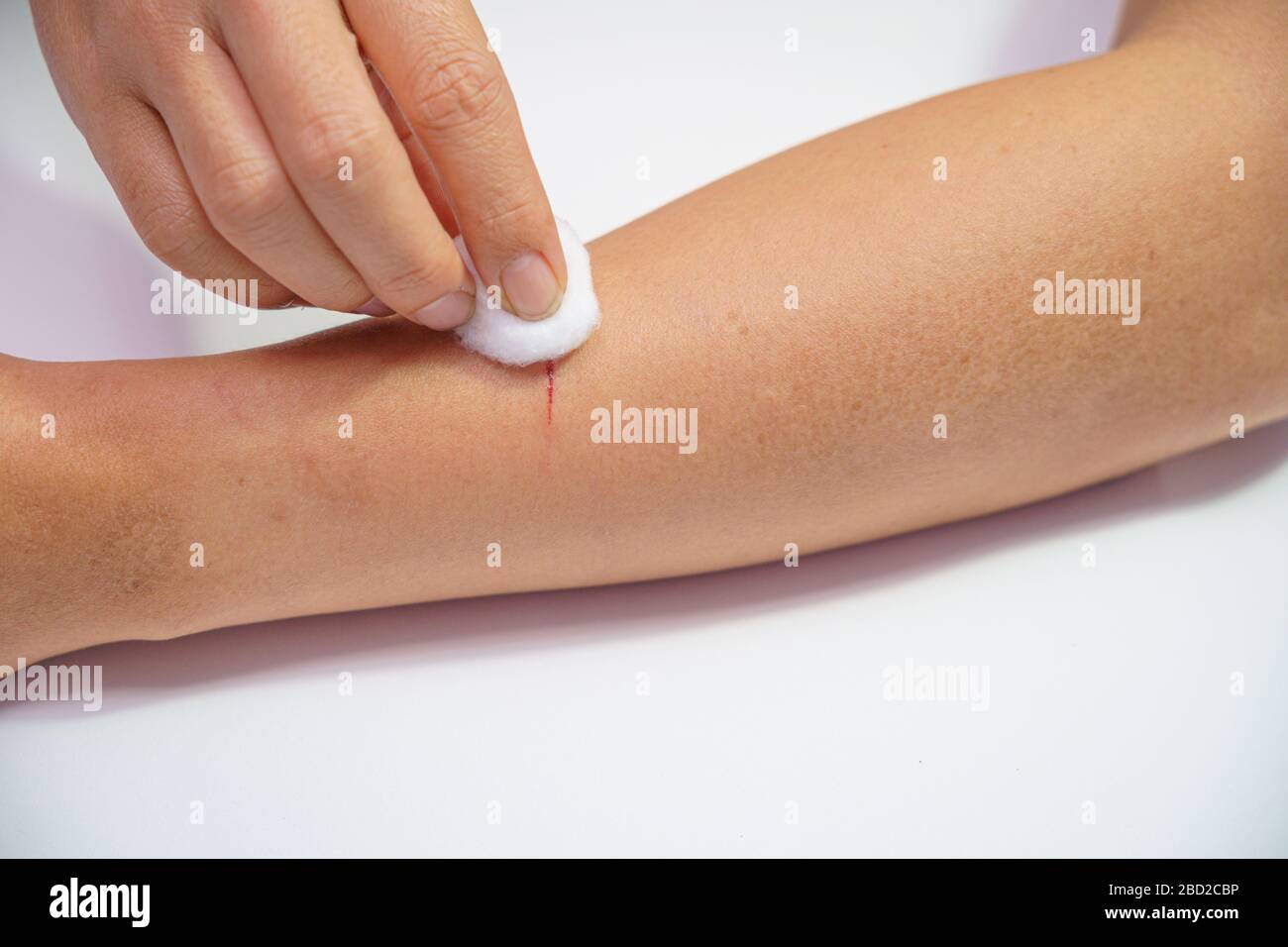 Hand laceration hi-res stock photography and images - Alamy