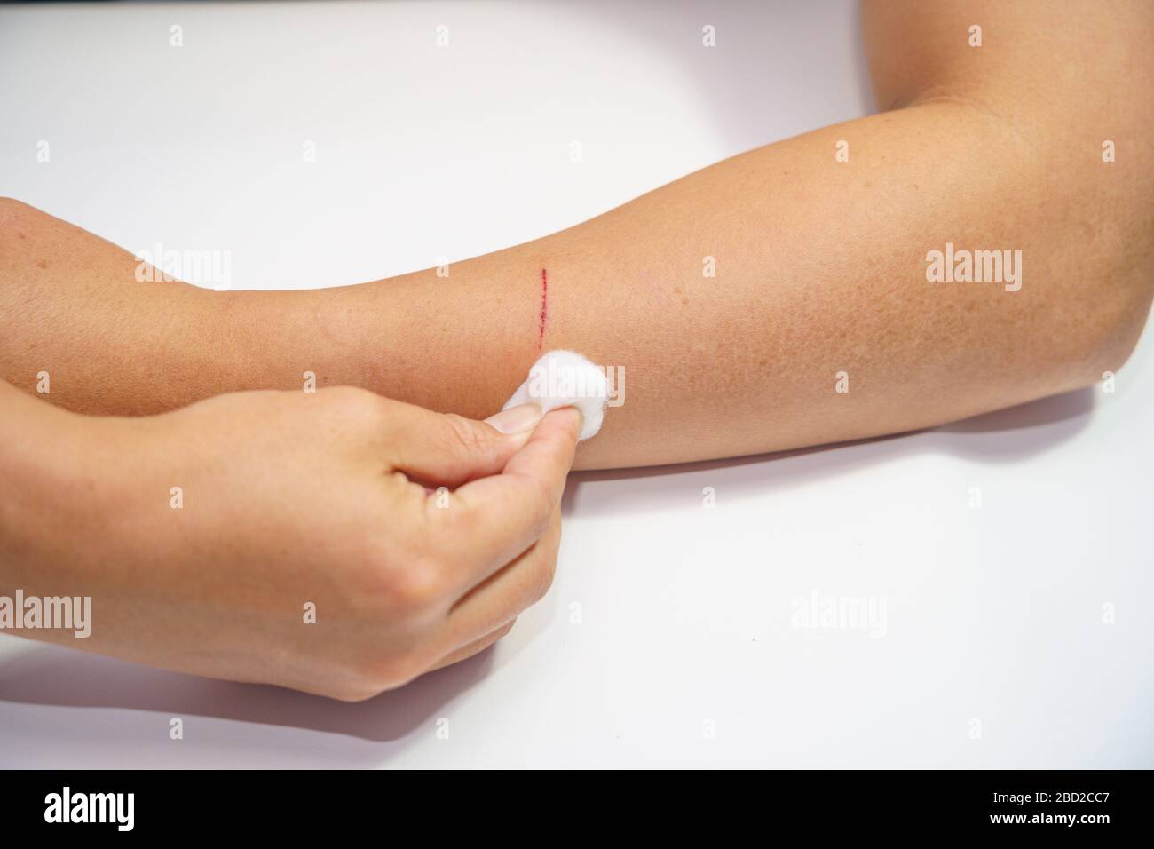 Bad wound hi-res stock photography and images - Alamy