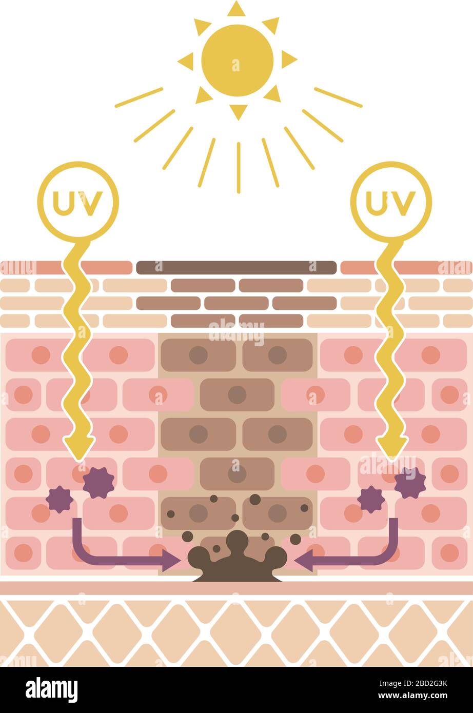mechanism of skin pigmentation / skin spot illustration Stock Vector ...