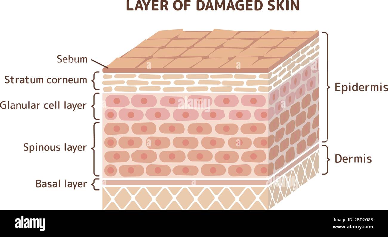Stratum Corneum High Resolution Stock Photography and Images - Alamy