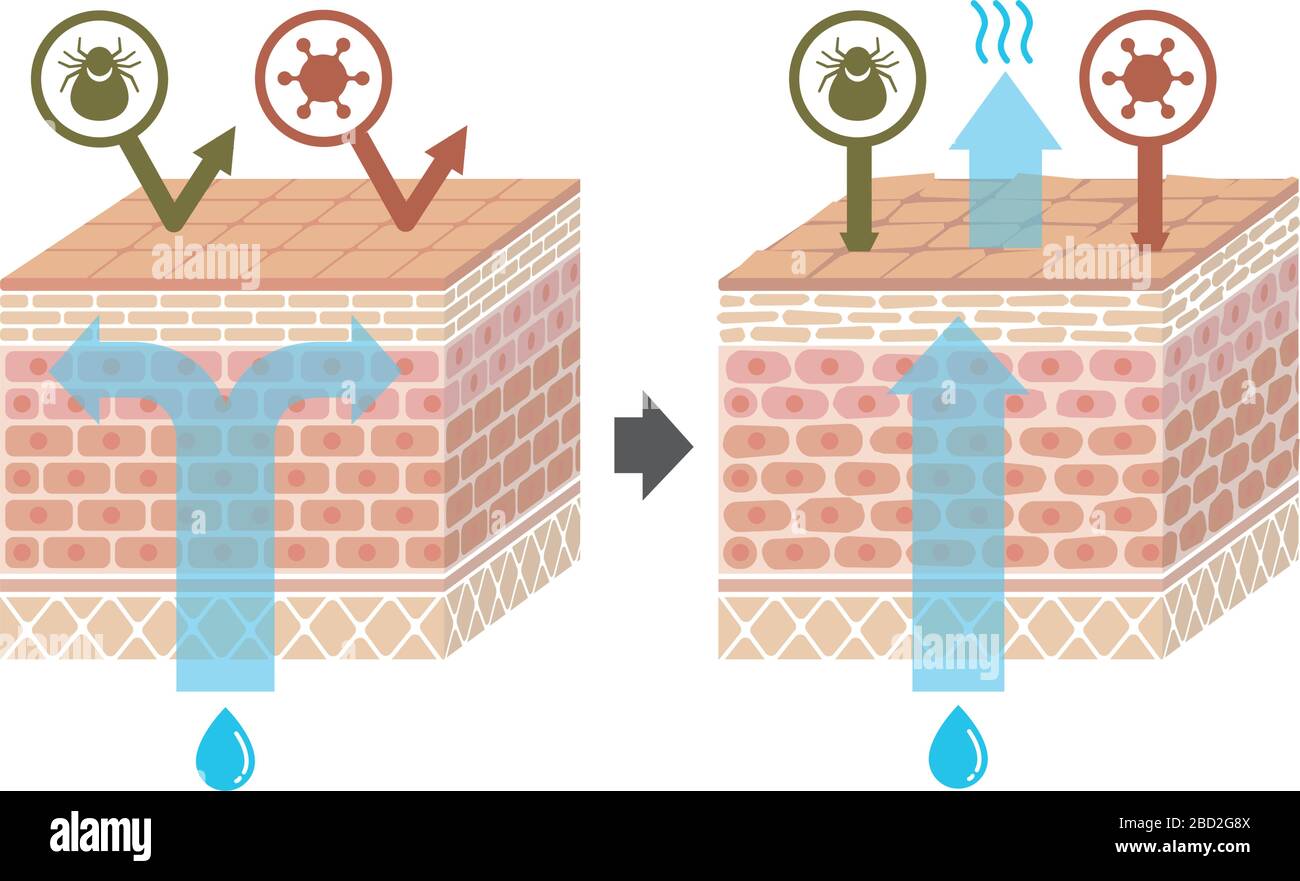 Sectional view of the skin.Comparison illustration of protection effect ...