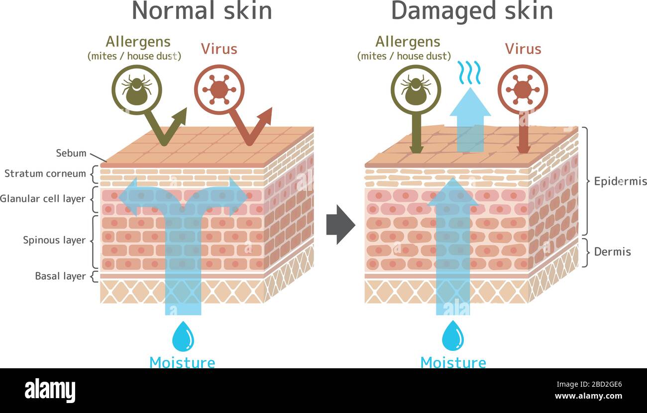 Sectional view of the skin.Comparison illustration of protection effect ...
