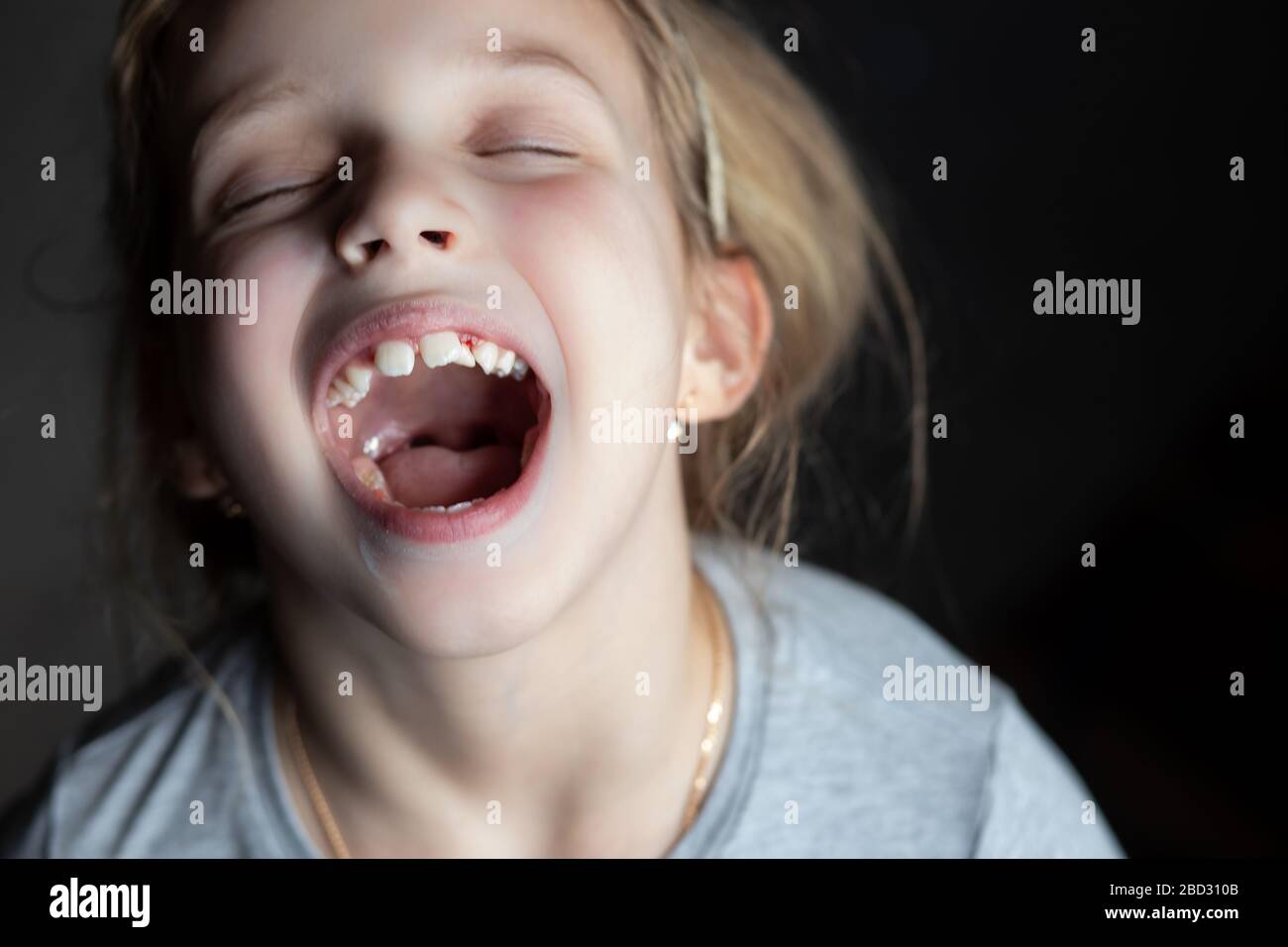 Childish cute mouth with beautiful lips and missing milk teeth dental ...