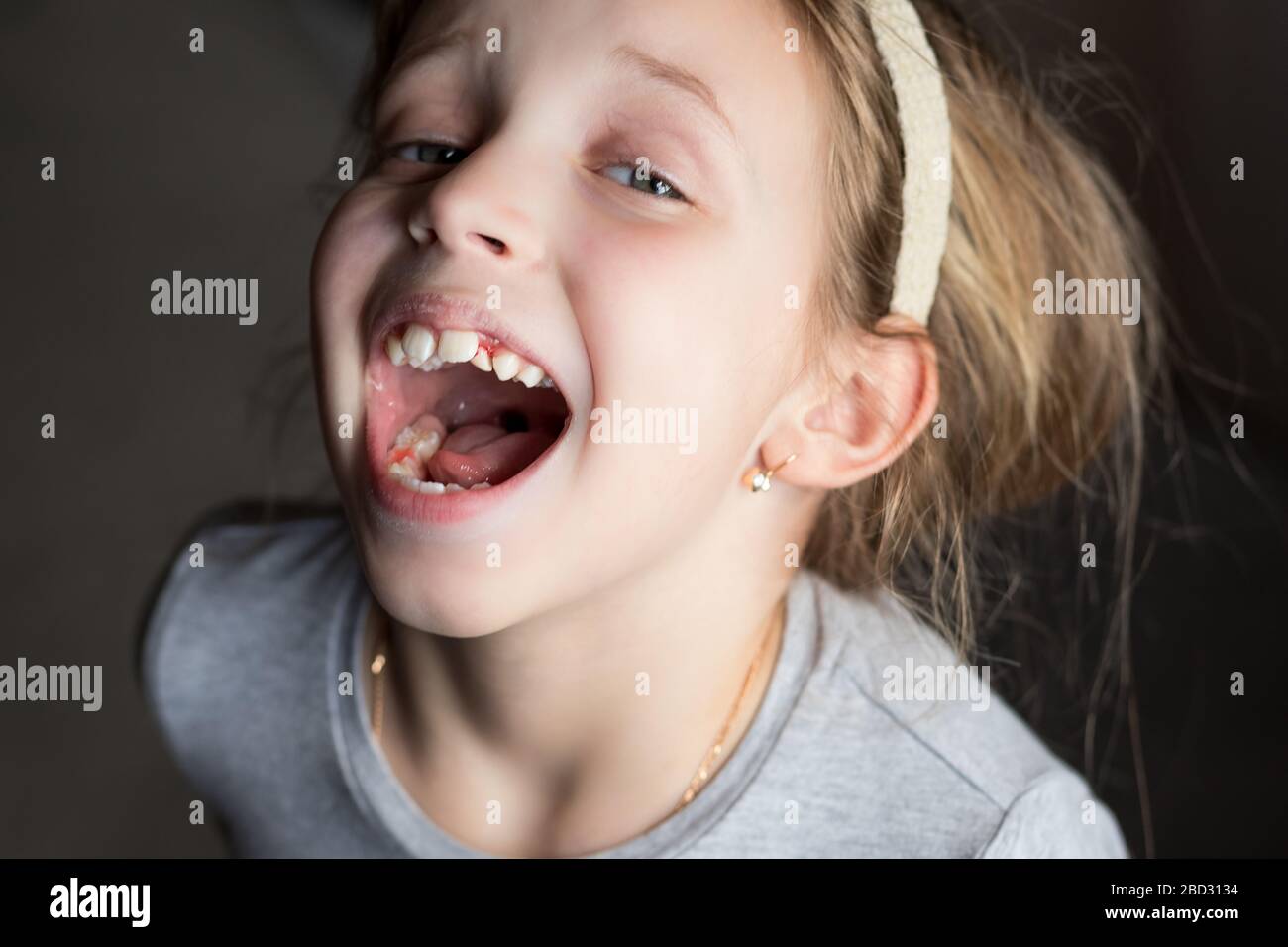 Childish cute mouth with beautiful lips and missing milk teeth dental ...