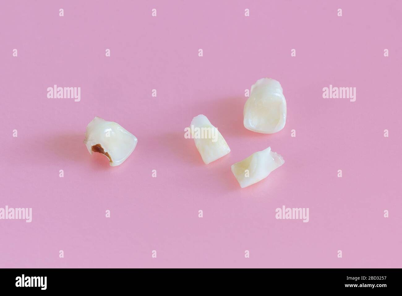 Three healthy and one caries-damaged baby teeth lie on a light pink ...