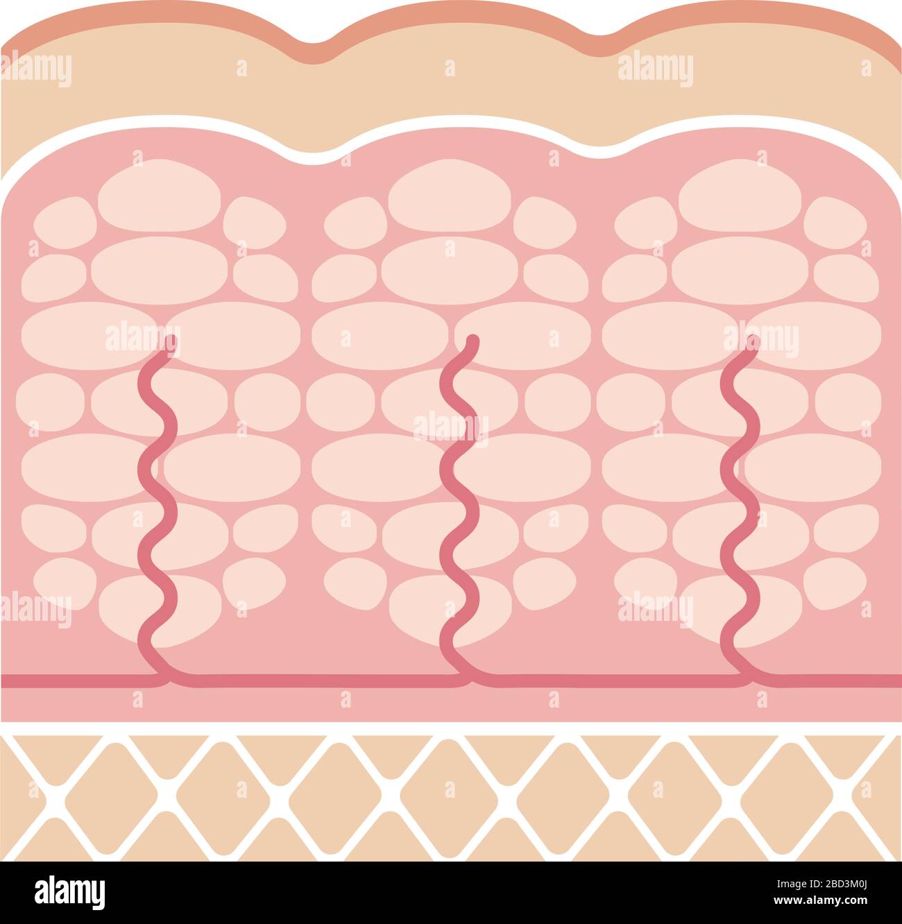 Cellulite's skin sectional view illustration Stock Vector Image & Art ...