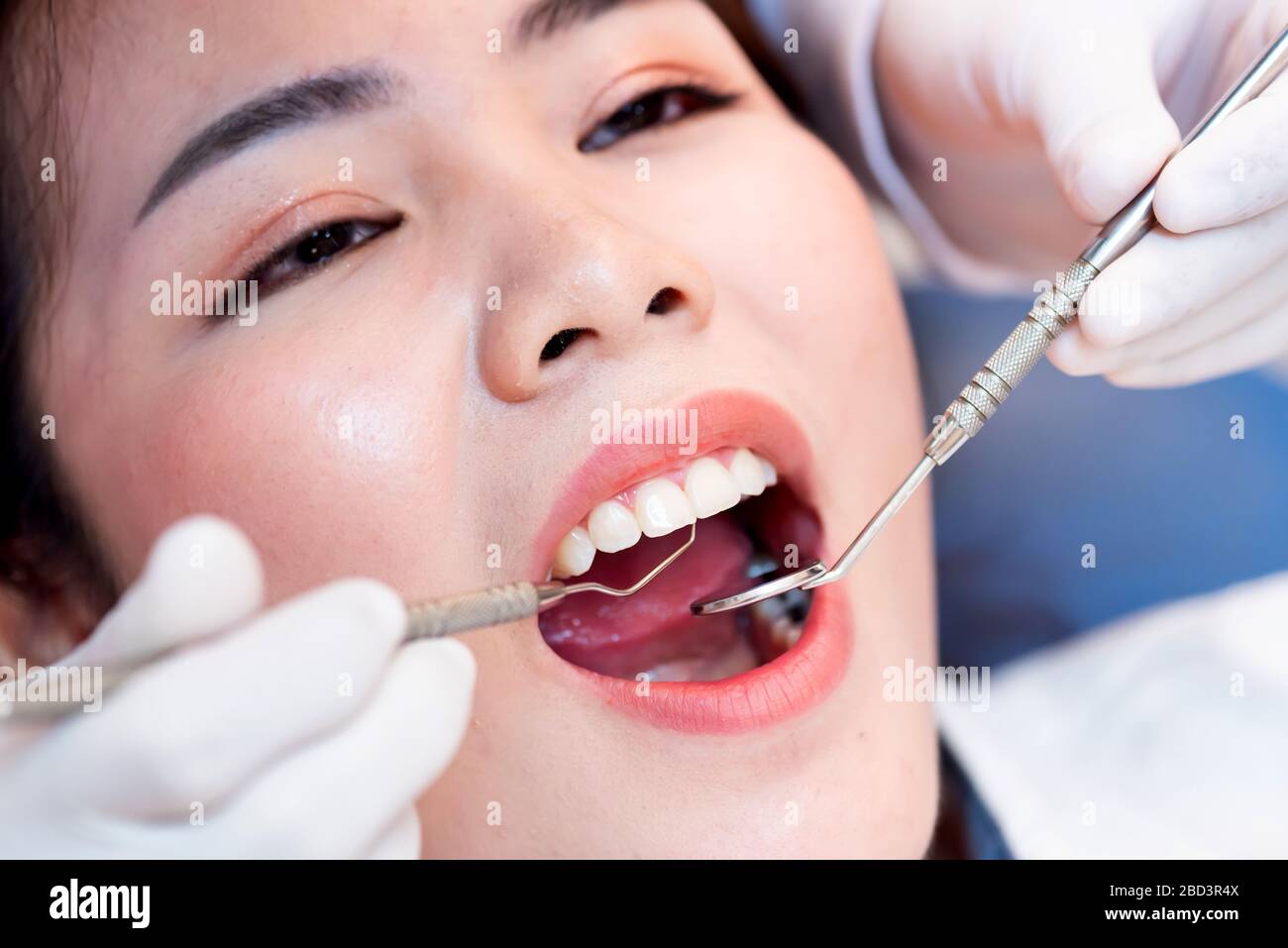 Dentistry and healthcare concept at dental clinic. Dentist check-up ...