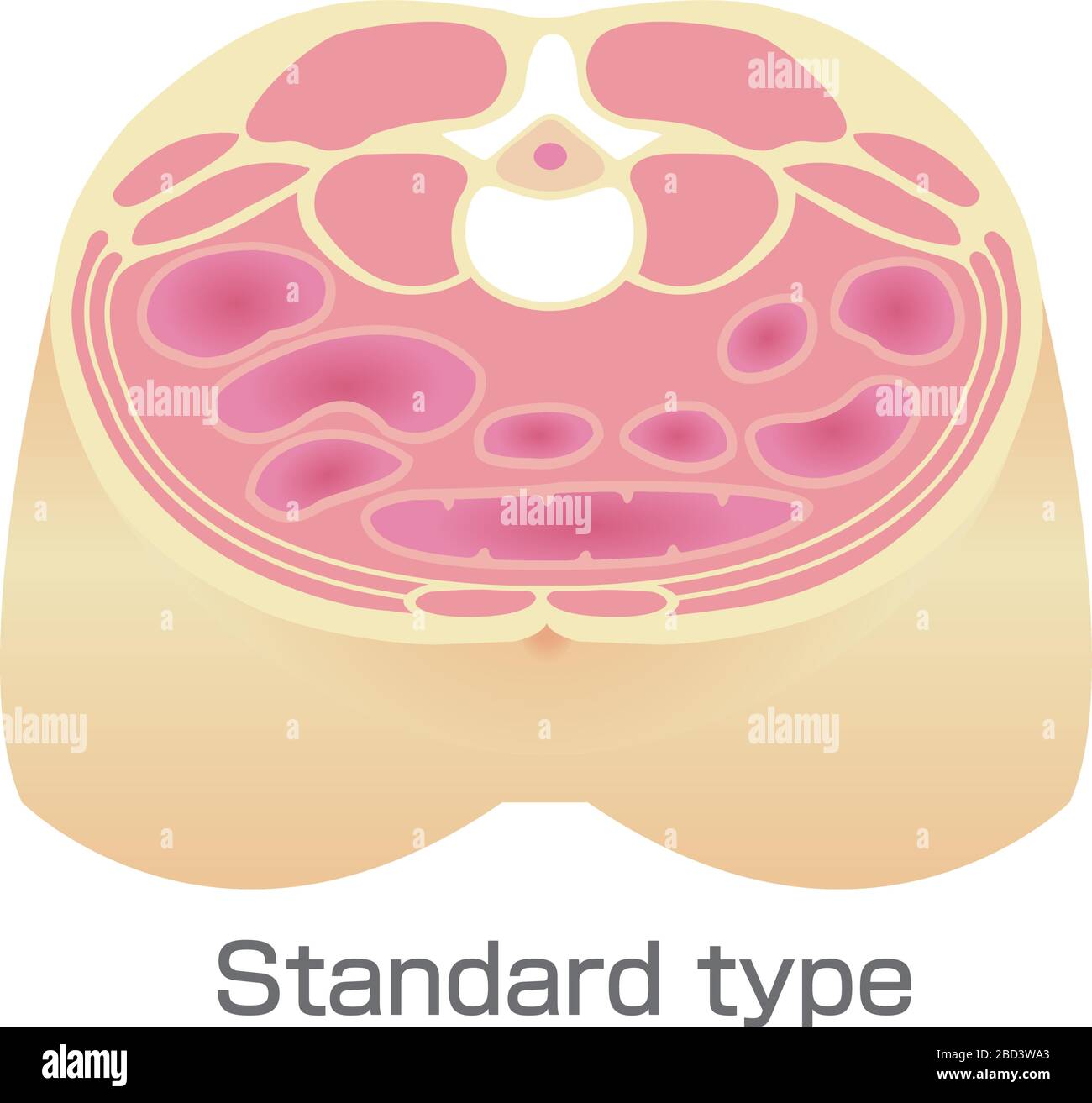 Type of obesity illustration . Abdominal sectional View . Healthy body ...